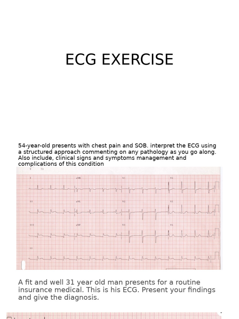 ECG EXERCISE | PDF