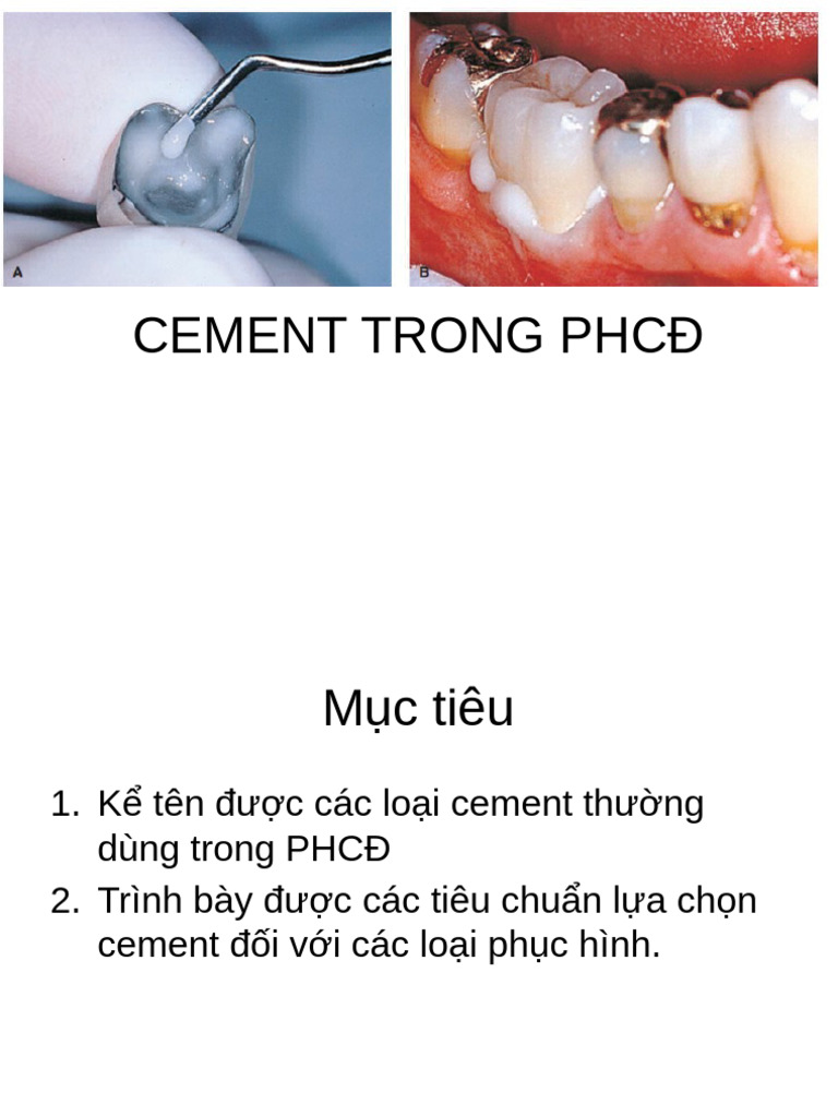 12.Rhm19-Cement Trong PHCD | PDF