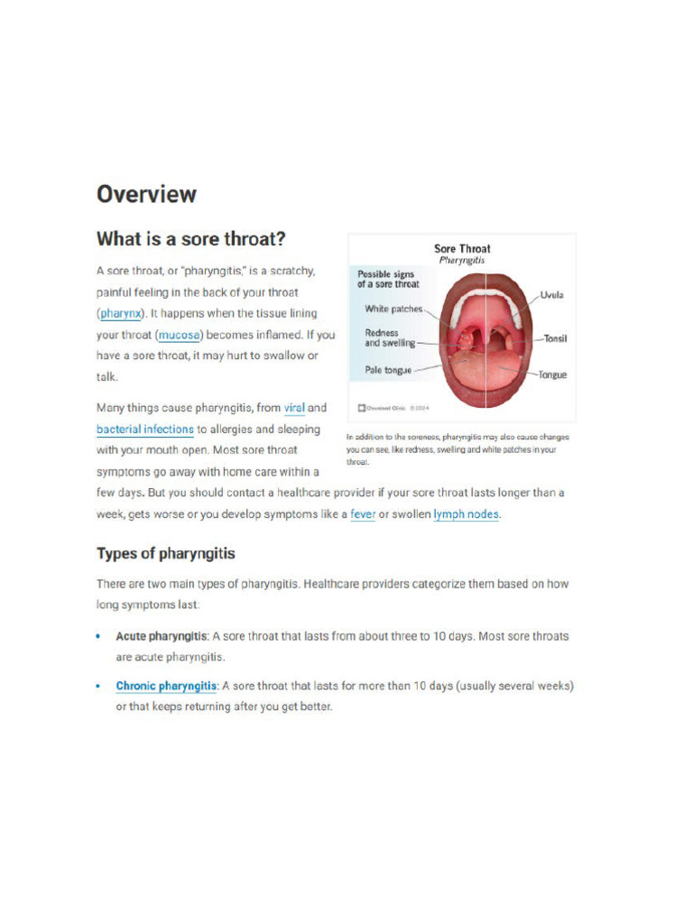 Sore Throat | PDF
