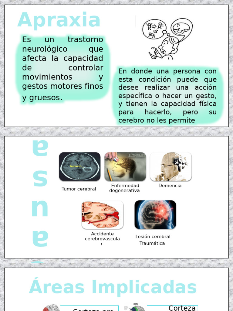 apraxia-tipos-causas-y-s-ntomas-pdf-cerebro-hemisferio-cerebral