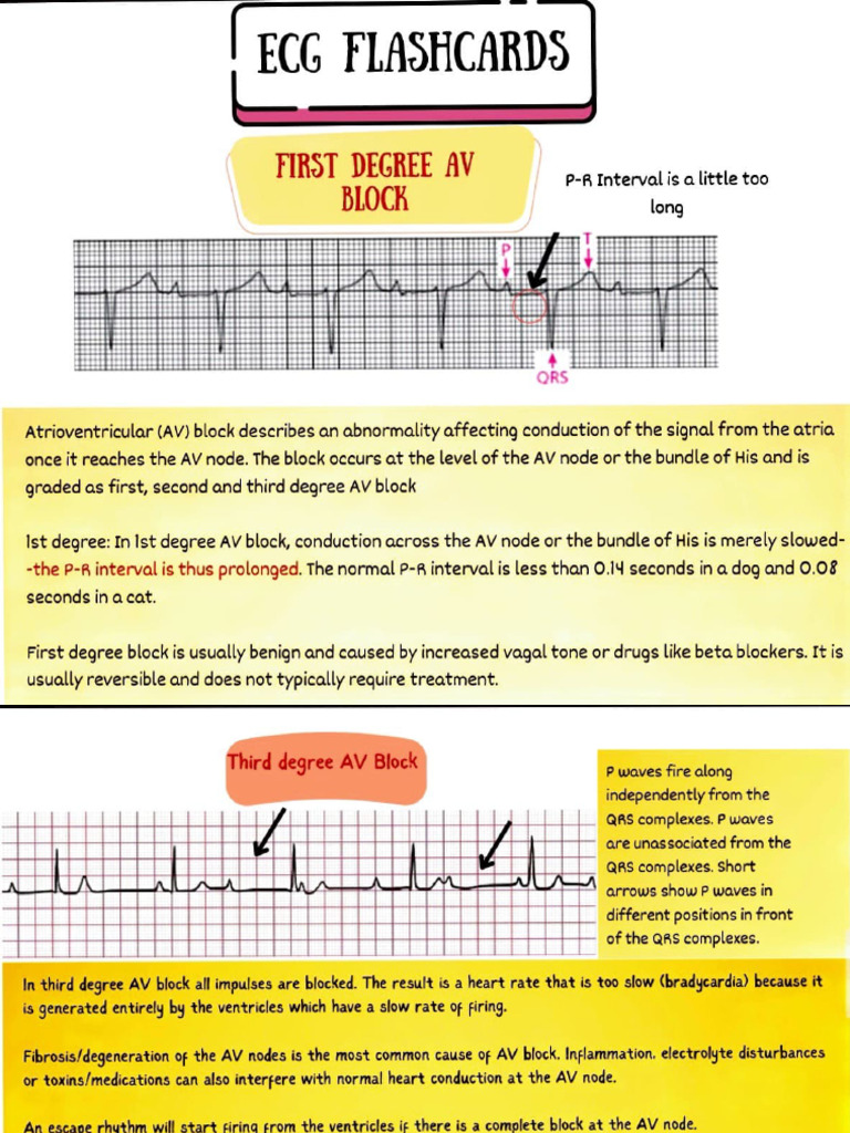 ECG Flash Cards | PDF | Cardiovascular System | Heart