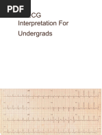 ECG Rhythm Analysis - Life in The Fast Lane ECG Library | PDF | Computers