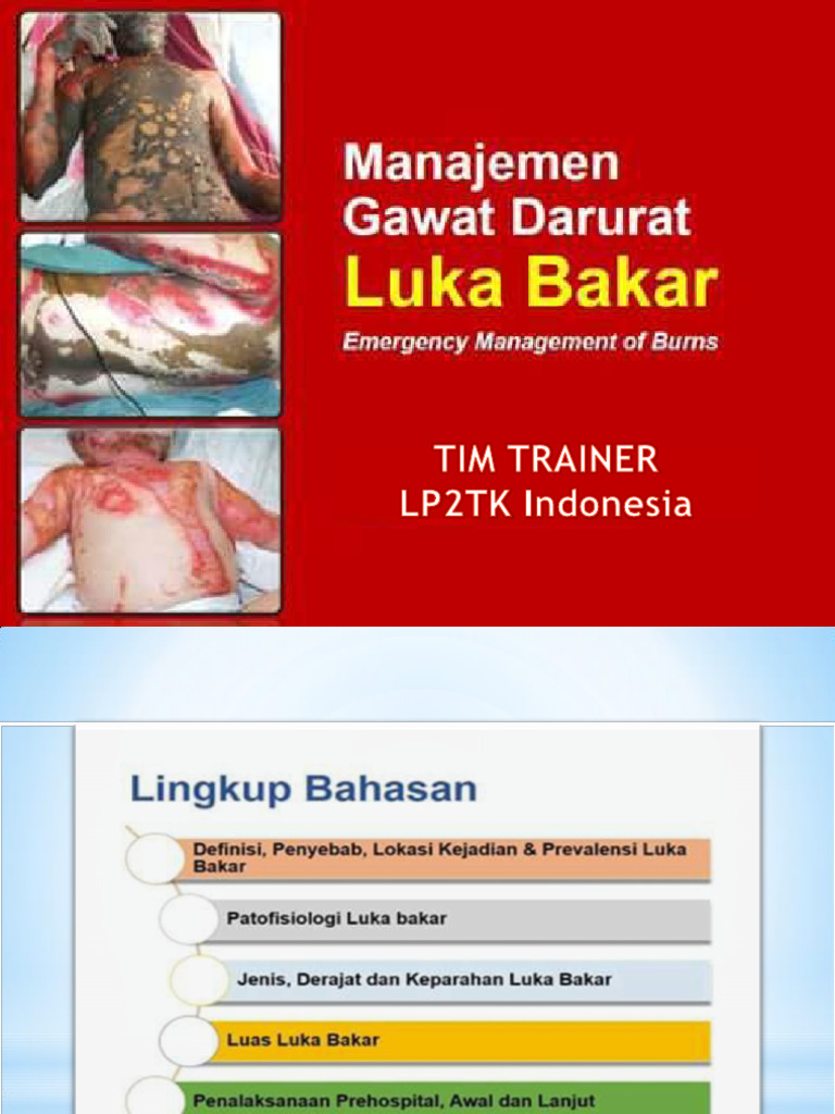 Trauma Luka Bakar | PDF