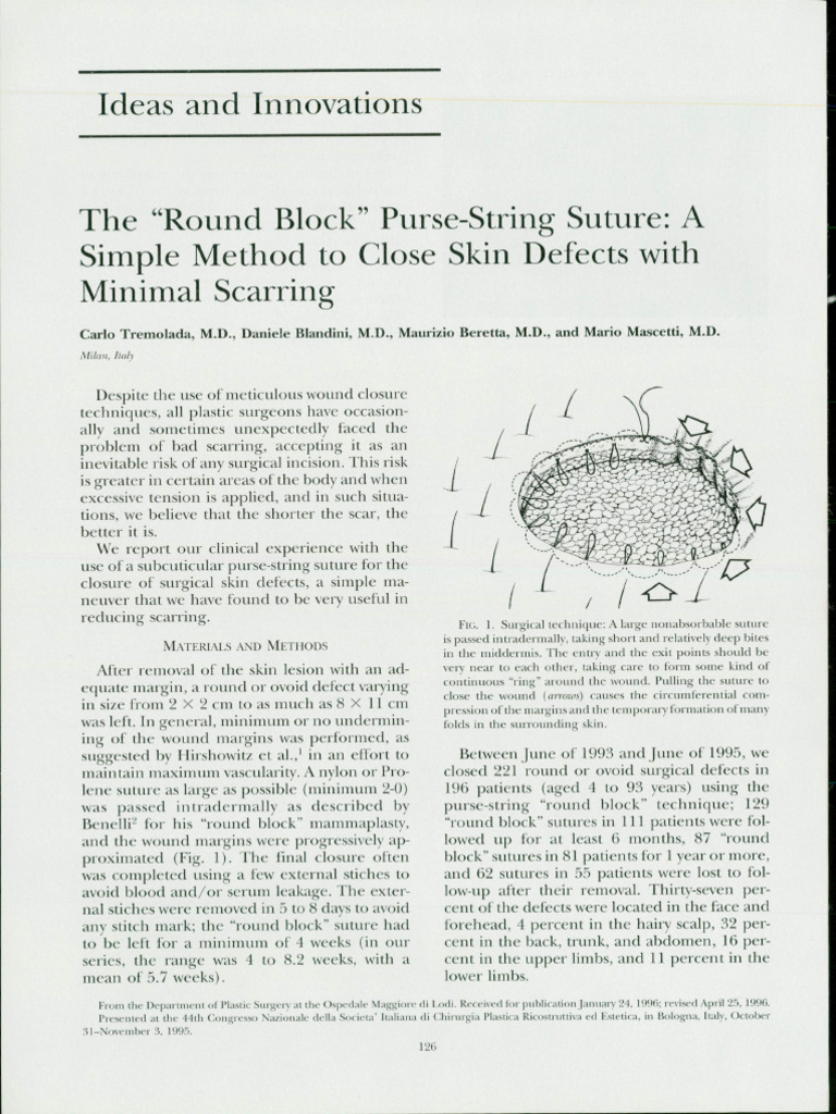 The Round Block Purse-String Suture: A Simple Method To Close Skin ...