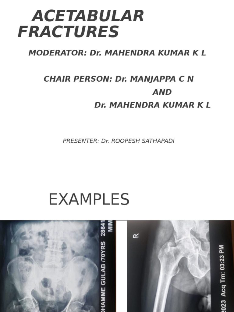 Indomethacin for HO Prophylaxis in Acetabular Fractures | PDF | Hip ...