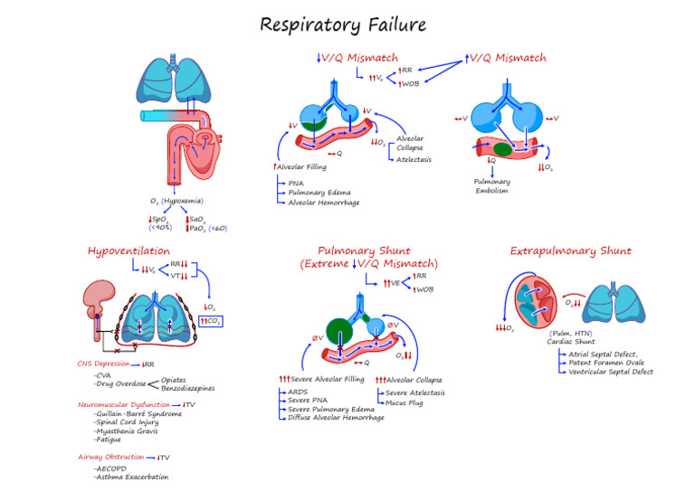 11 - Respiratory Failure (Illustrations Key) | PDF | Respiratory ...