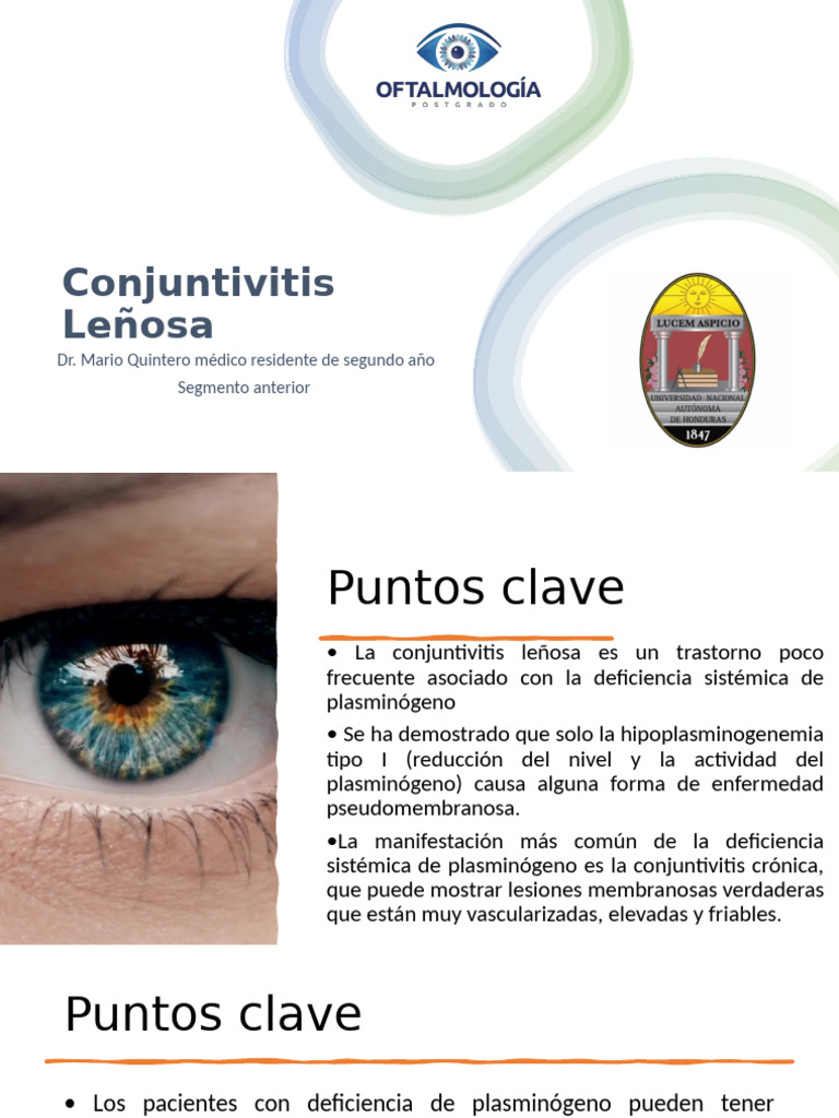 Conjuntivitis Leñosa | PDF | Inflamación | Mutación