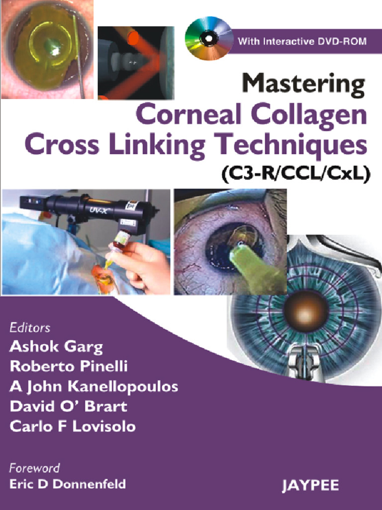 Corneal Collagen Cross Linking Techniques | PDF | Cornea | Human Eye