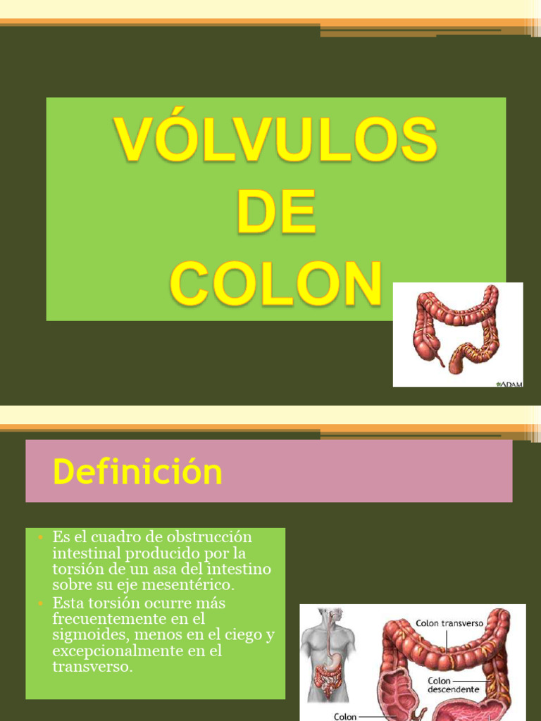 Volvulo Del Colon | PDF | Intestino grueso | Medicina CLINICA