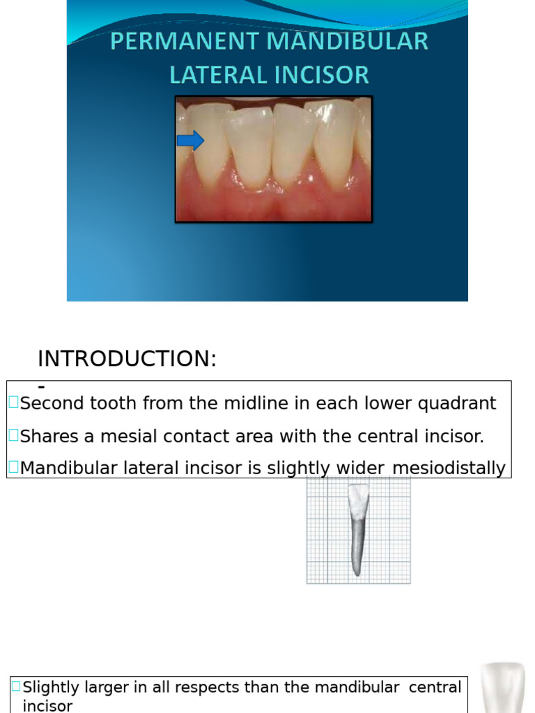 Mandibular Lateral Incisor Overview | PDF | Dental Anatomy | Tooth