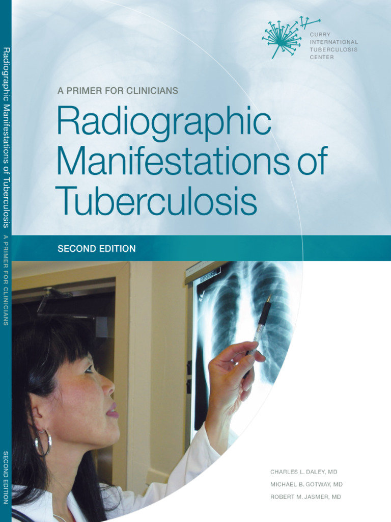 Radiographic Manifestations of Tuberculosis. Reprint 2020 | PDF ...