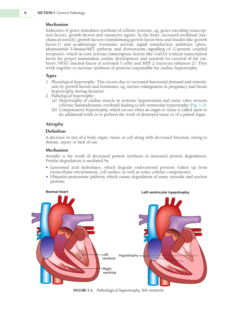 Cell Injury and Cell Death 2 | PDF | Epithelium | Atrophy