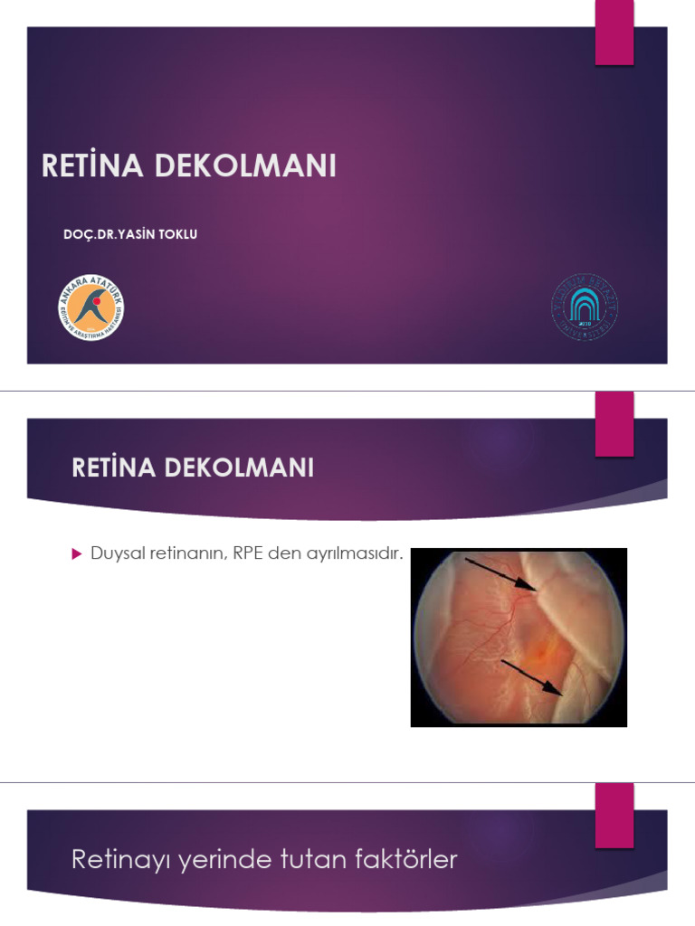 14) Reti̇na Dekolmani Slayt | PDF
