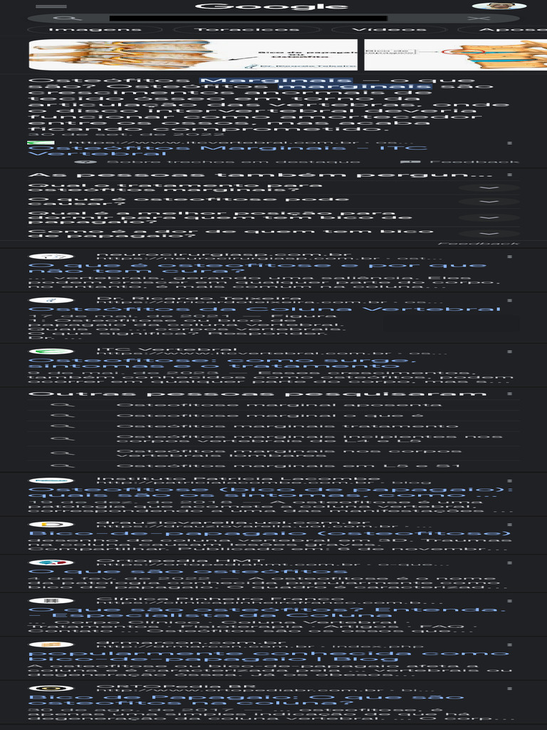 Osteofitose Marginal Nos Corpos Vertebrais - Pesq | PDF | Coluna ...