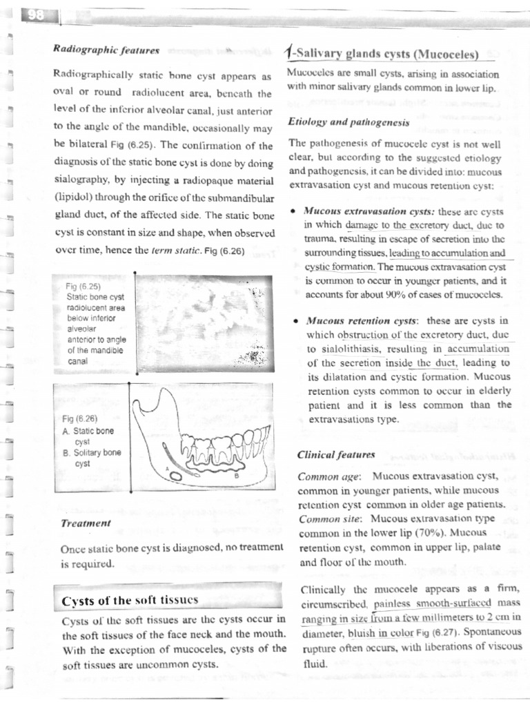 Cyst of Soft Tissues - 20231106-0940 | PDF