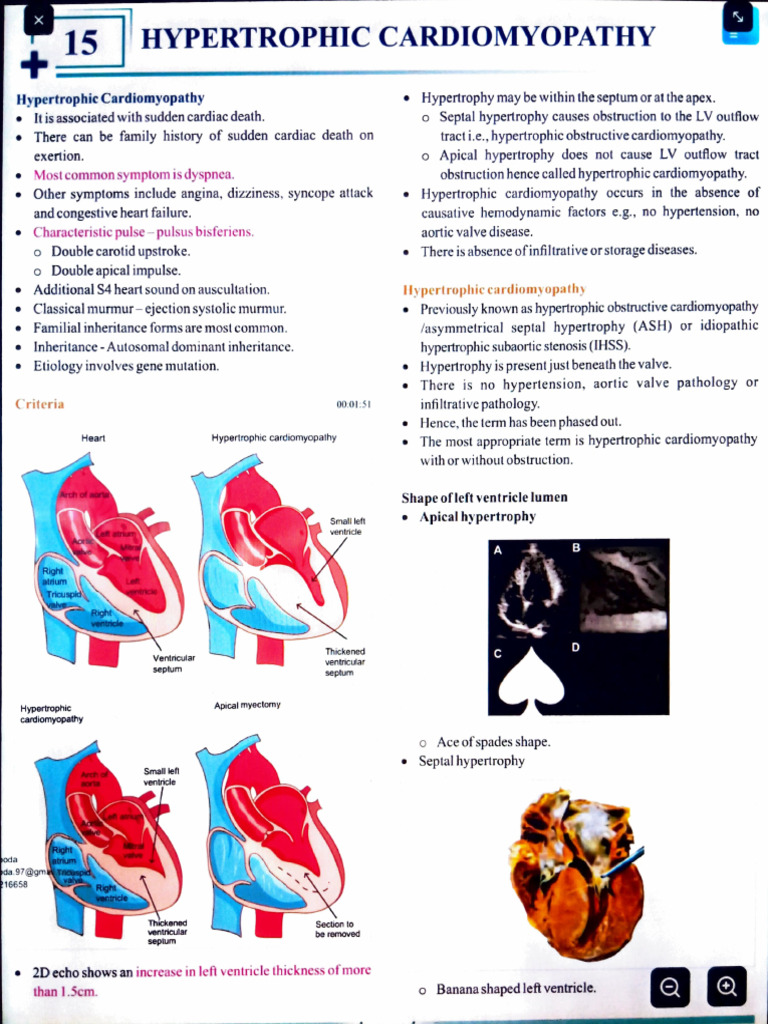 Hypertrophic Cardiomyopathy | PDF