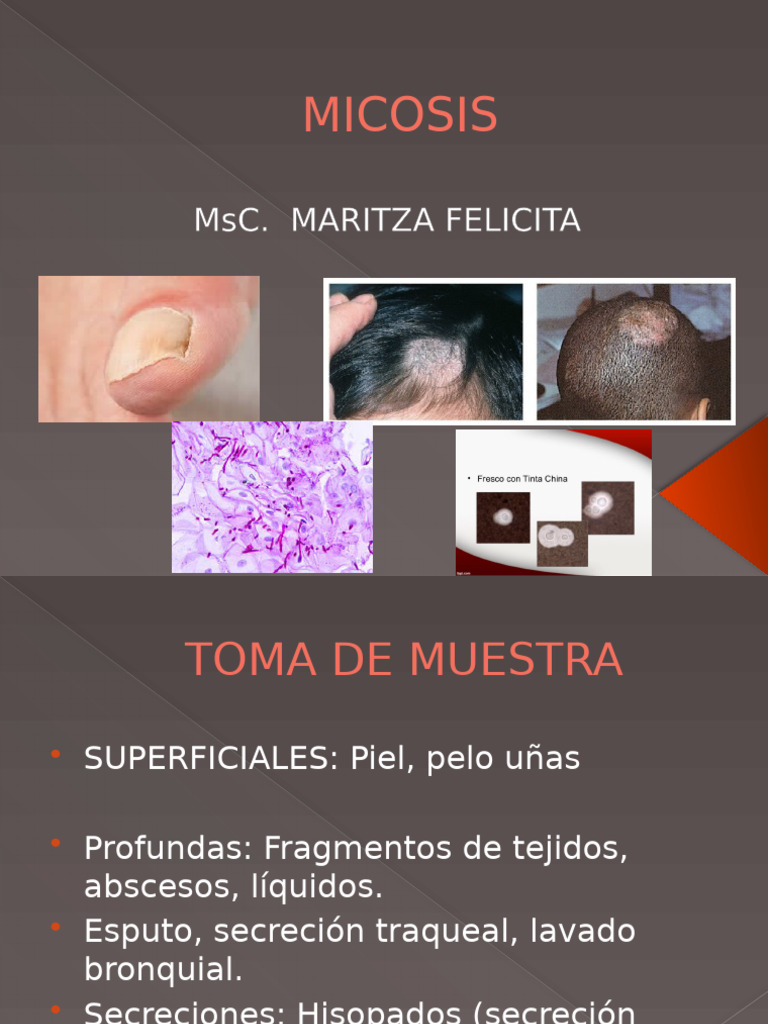 Toma y Procesamiento de Muestras de Micosis | PDF