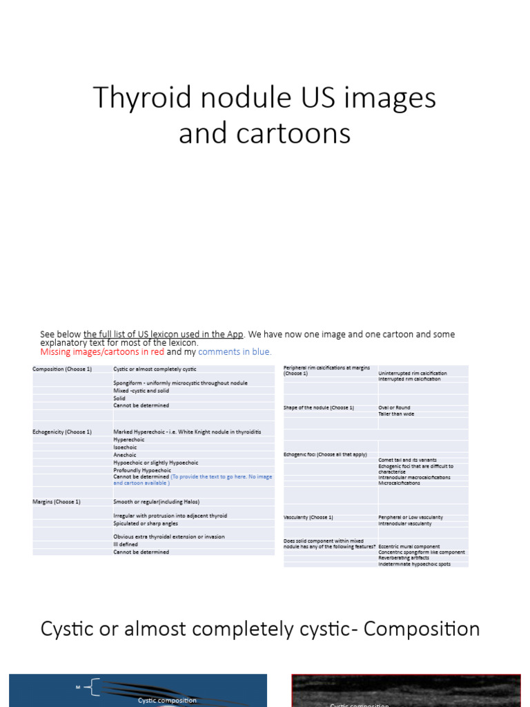 Thyroid Nodules- description | PDF | Thyroid