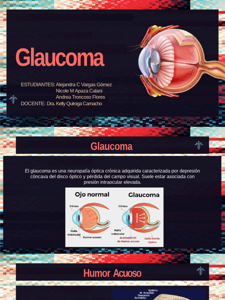 Glaucoma 1 | PDF | Glaucoma | Percepción visual