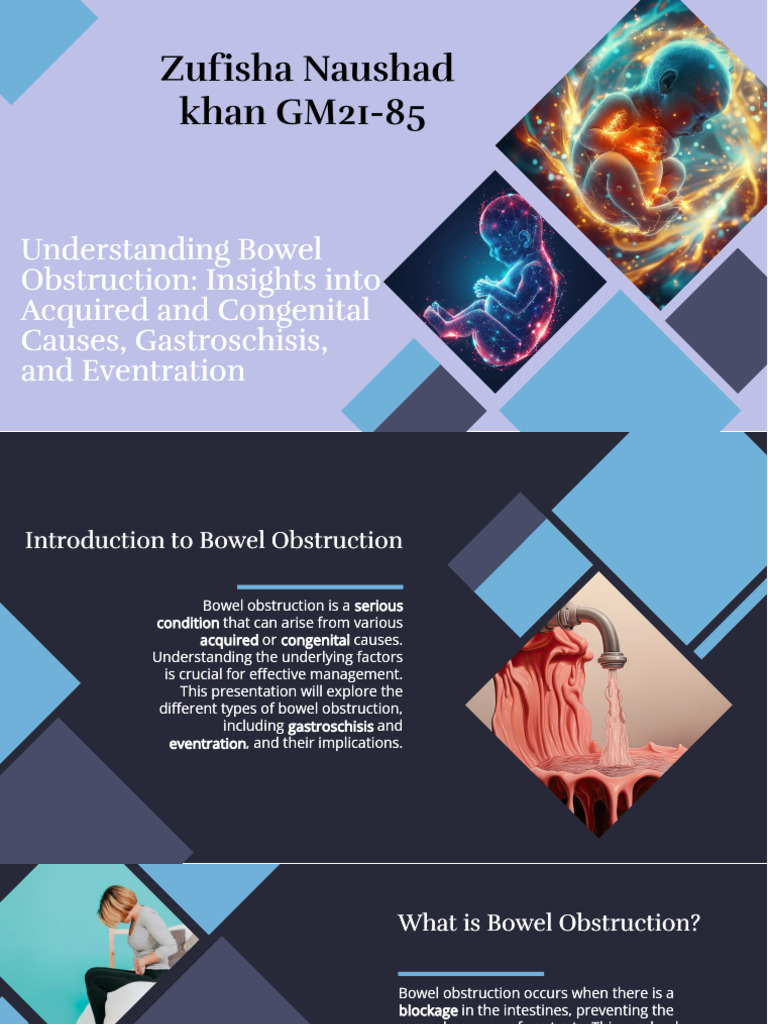 wepik-understanding-bowel-obstruction-insights-into-acquired-and ...