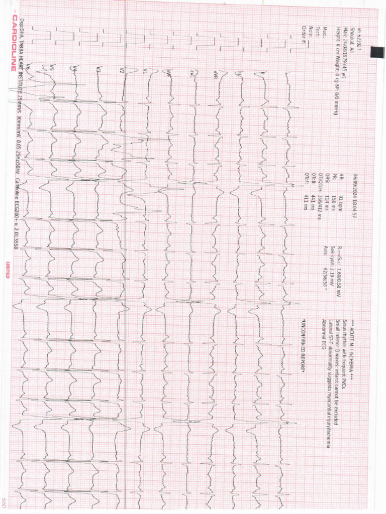 Ecg 1 | PDF