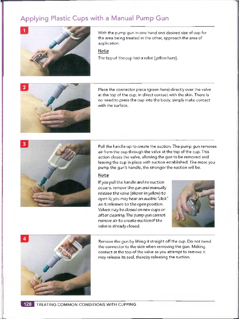 The Guide To Modern Cupping Therapy Your Step by Step Shannon Gilmartin ...