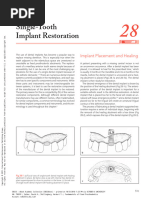 Implant Driver Compatibility-Chart | PDF | Dental Implant | Dentistry