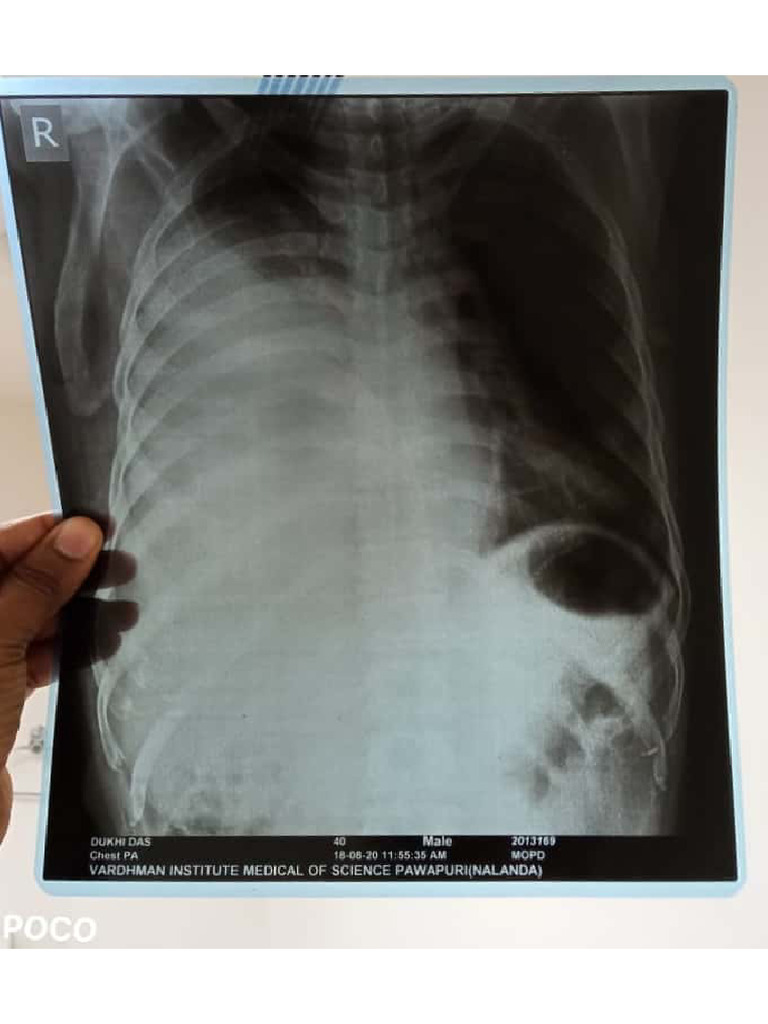 Med x-ray | PDF