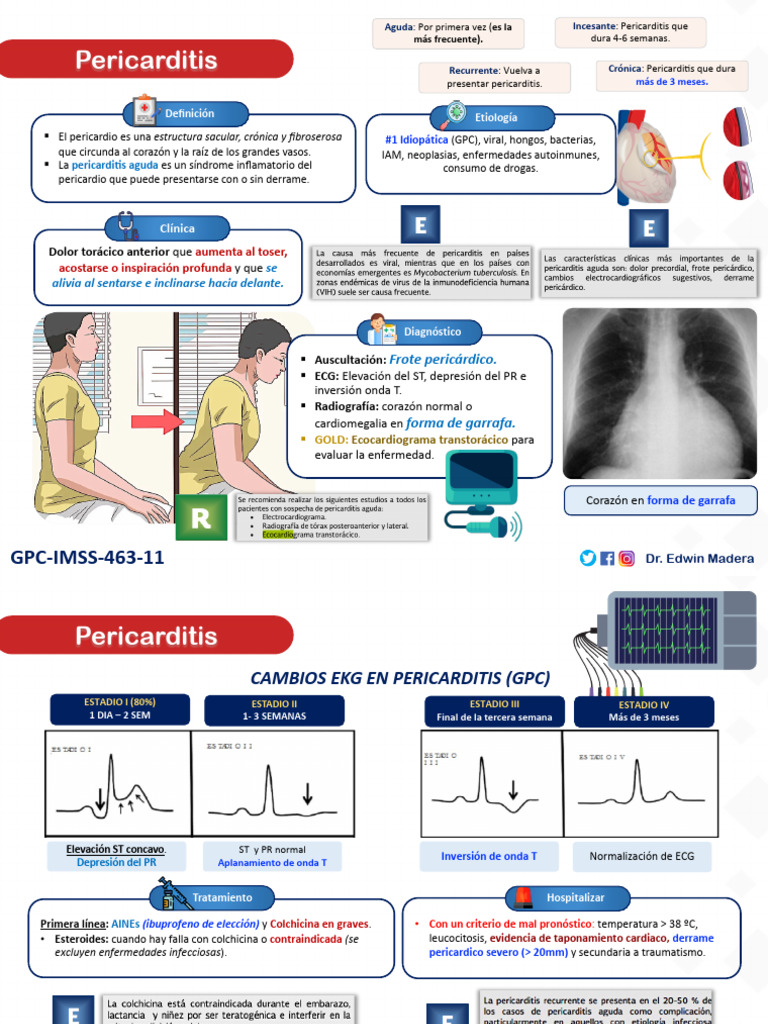 Guía de Pericarditis Aguda IMSS | PDF | Enfermedades y trastornos ...