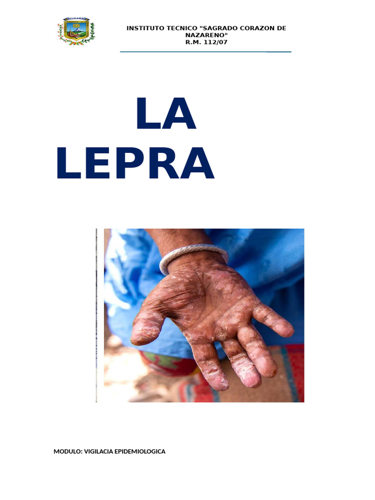 Lepra: Vigilancia y Prevención | PDF | Lepra | Infección