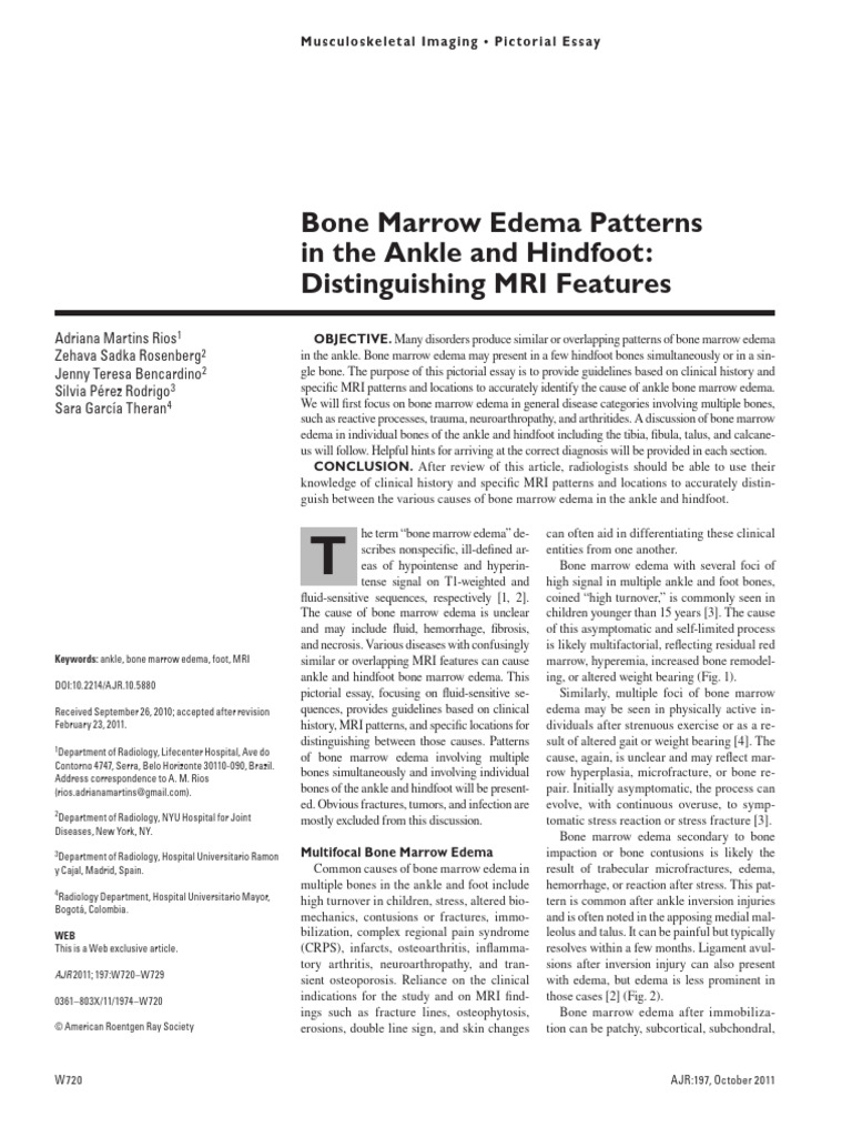 Rios Et Al 2012 Bone Marrow Edema Patterns in the Ankle and Hindfoot ...