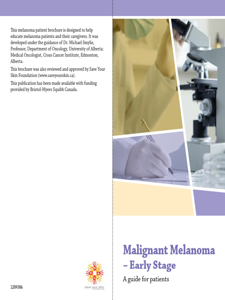 Early Stage Malignant Melanoma Guide | PDF | Melanoma | Biopsy
