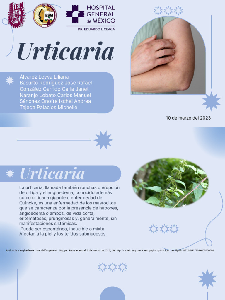 Urticaria | PDF | Medicina | Medicina CLINICA