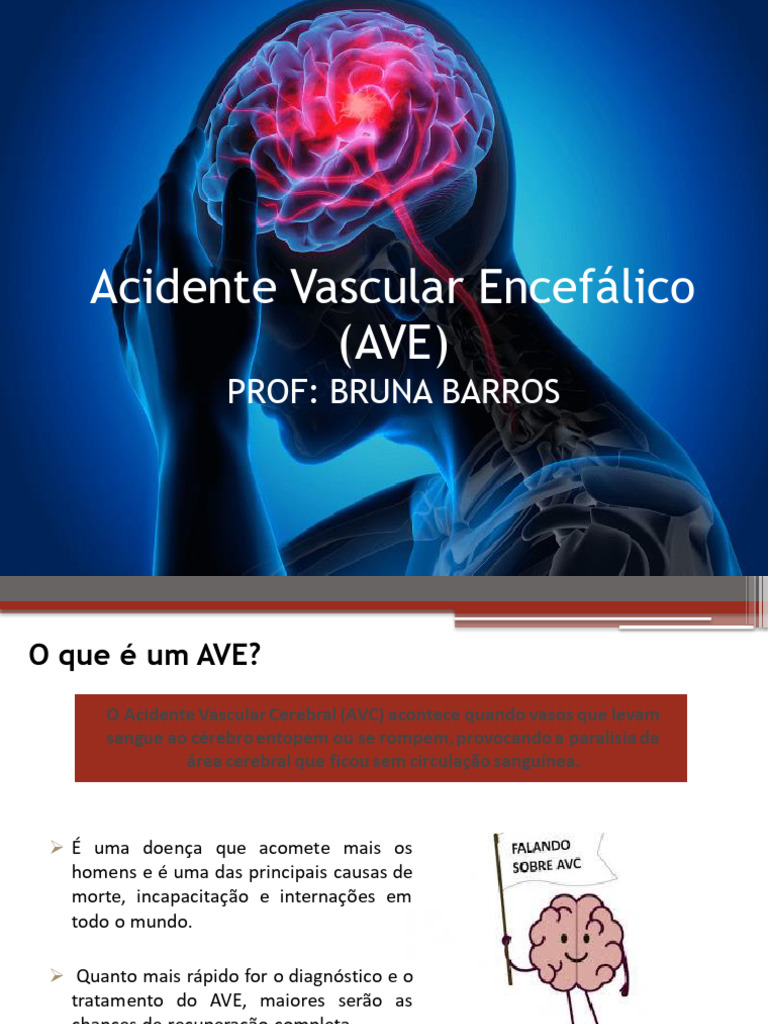 Aula 07 - AVC | PDF | AVC | Epidemiologia