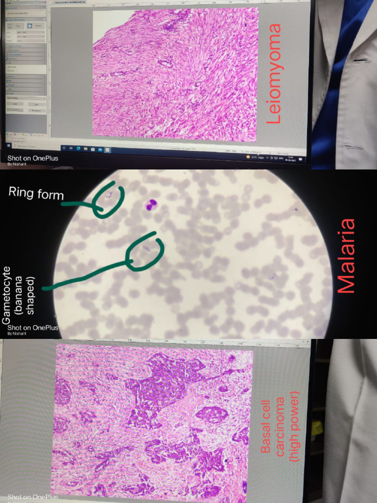 Patho Labelled Histo Slides | PDF