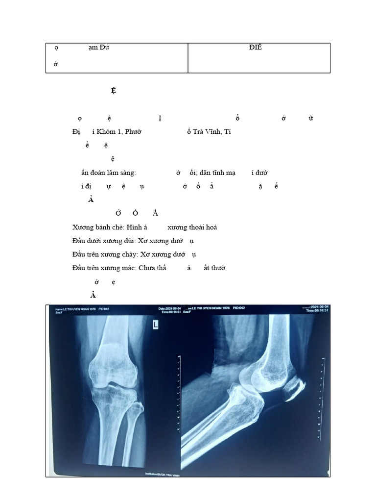 Pham Duc Nhan - B.A XQ | PDF