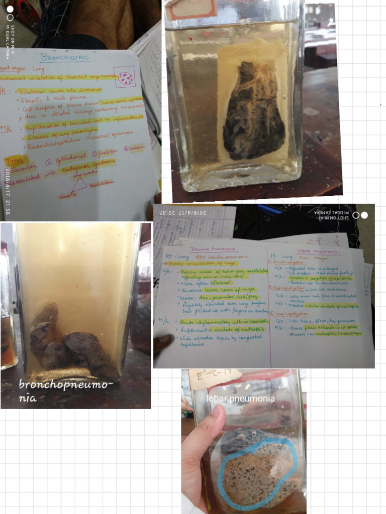 Patho Gross and Instruments | PDF | Diseases And Disorders | Anatomy