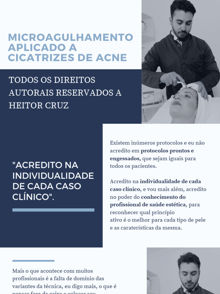 Protocolo Cicatrizes de Acne | PDF
