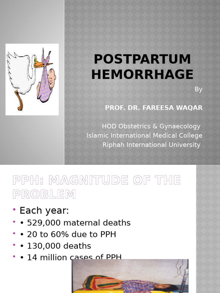 Understanding Postpartum Hemorrhage Risks | PDF | Childbirth | Medical ...