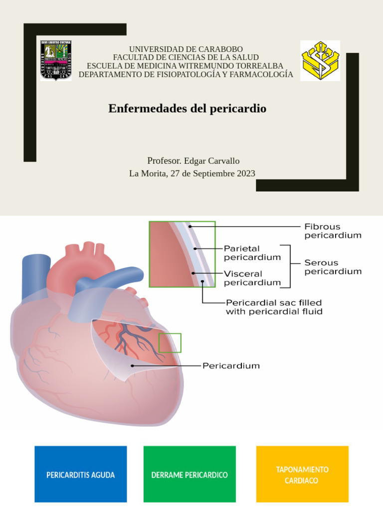 Enfermedades del Pericardio: Derrame Pericárdico | PDF