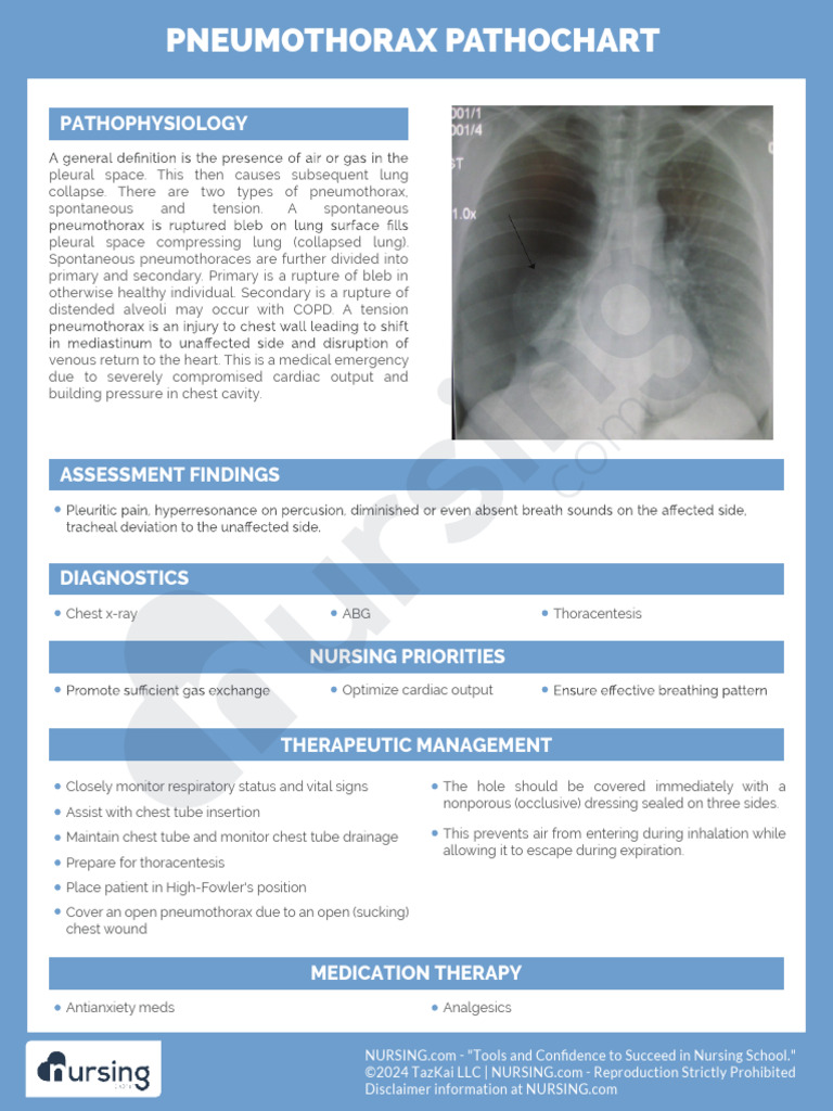 Cs Resp 005 Pneumothorax - Patho - Chart 1 1 | PDF