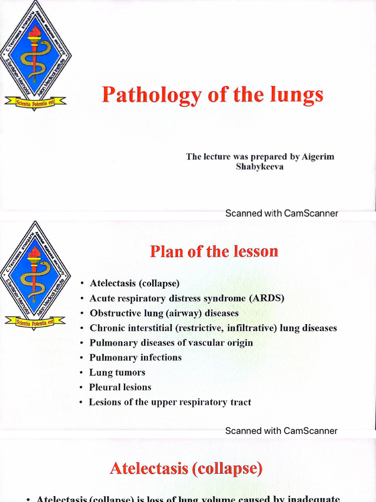 Pathology of the lung | PDF