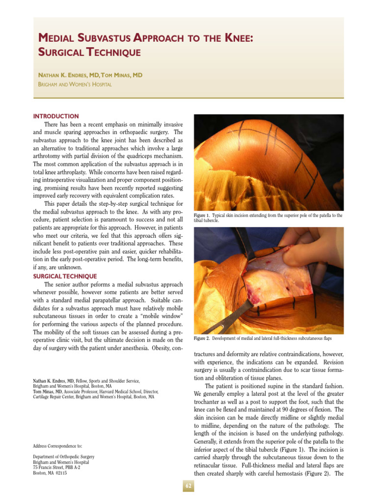 subvastus approach for knee replacement | PDF | Knee | Musculoskeletal ...