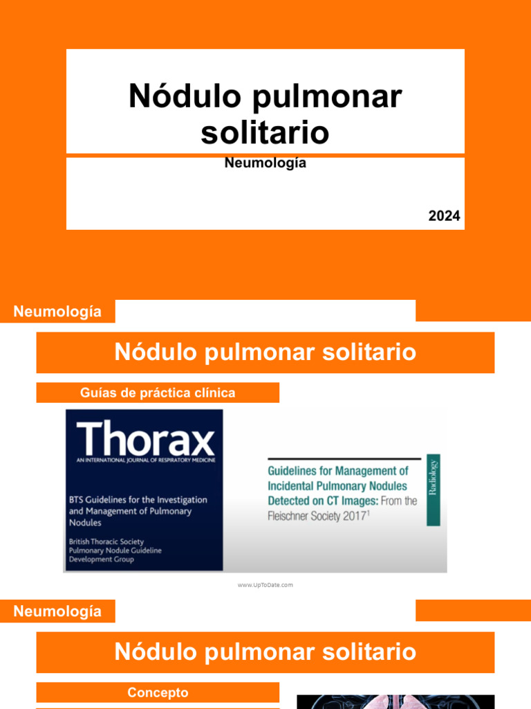 Evaluación del Nódulo Pulmonar Solitario | PDF | Neumología | Cáncer de pulmón