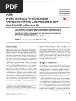 mini-tightrope-cmc-fixation | PDF | Thumb | Musculoskeletal System