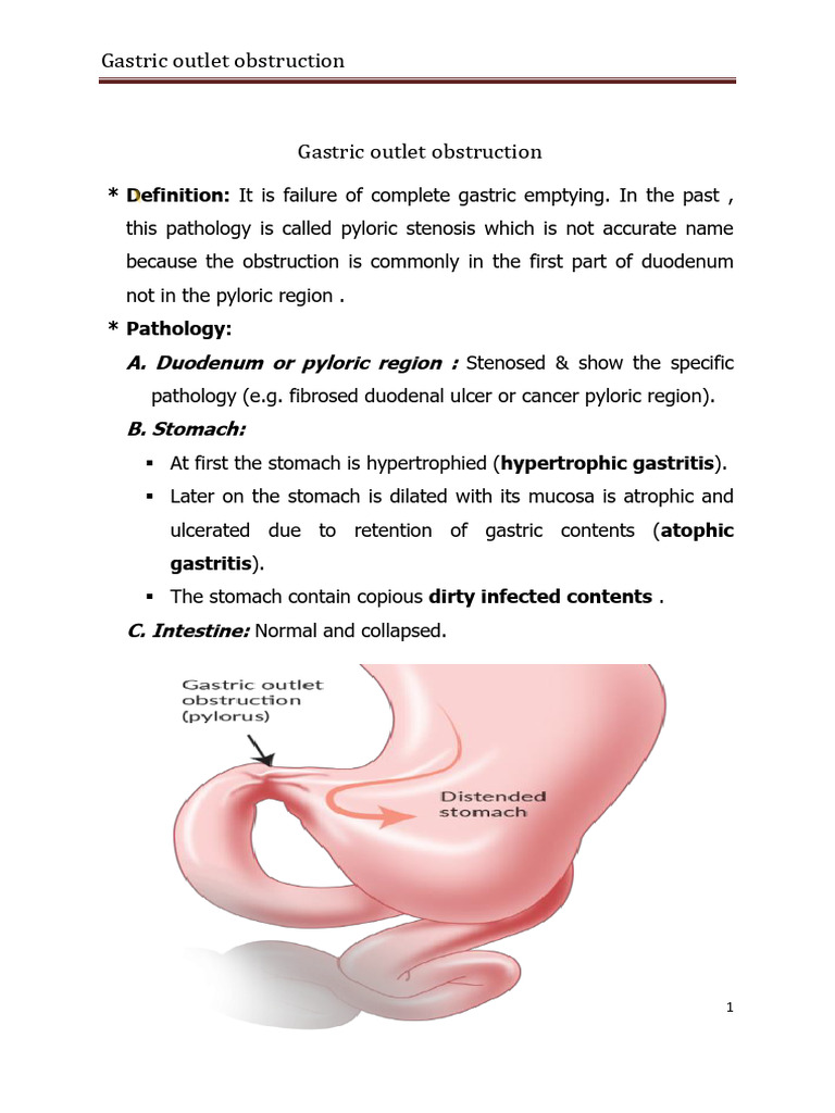 Gastric Outlet Obstruction | PDF | Stomach | Gastroenterology