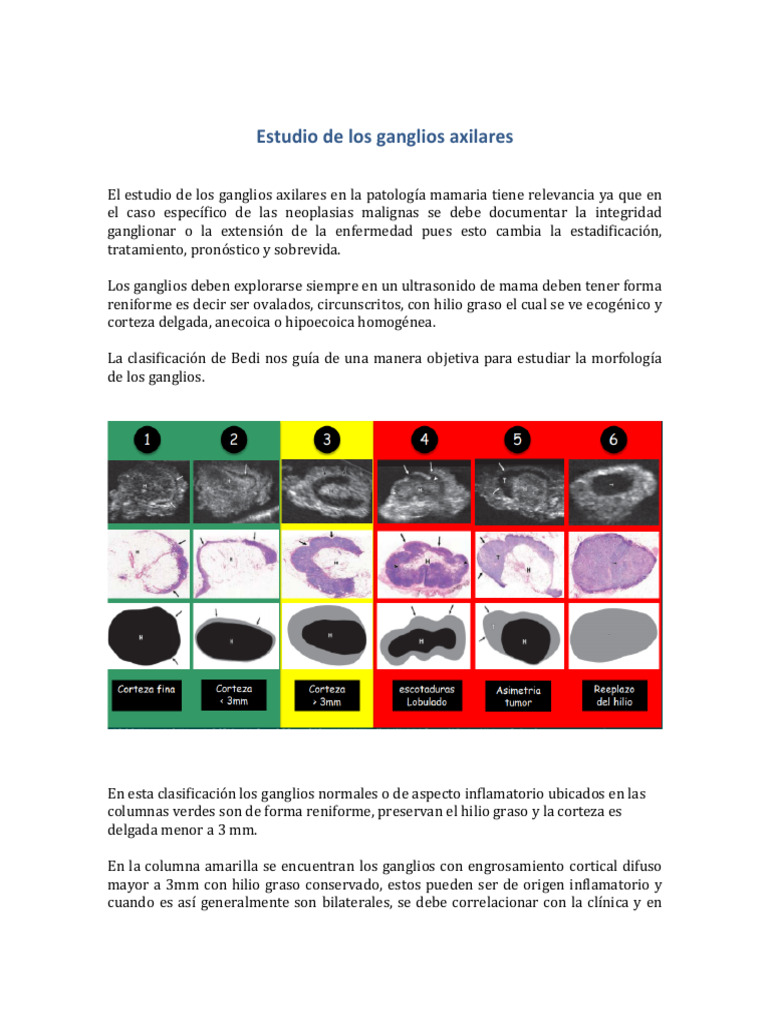 Estudio de Los Ganglios Axilares | PDF | Ganglio linfático | Metástasis