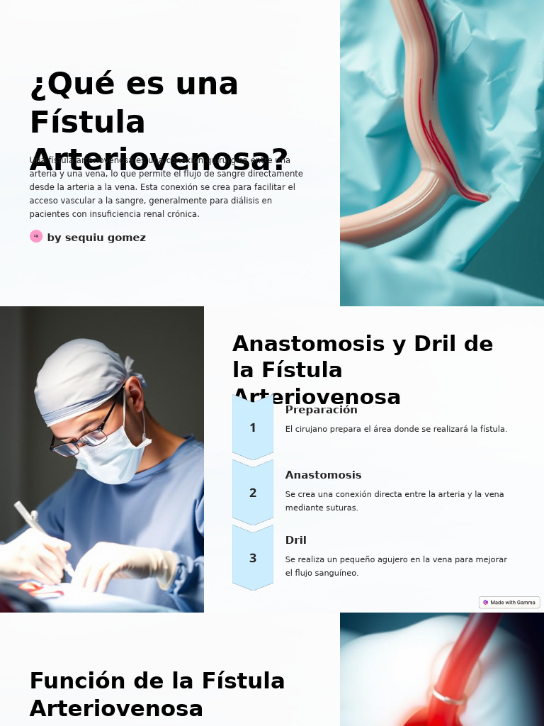 Fístula Arteriovenosa: Guía Completa | PDF | Terapia intravenosa ...