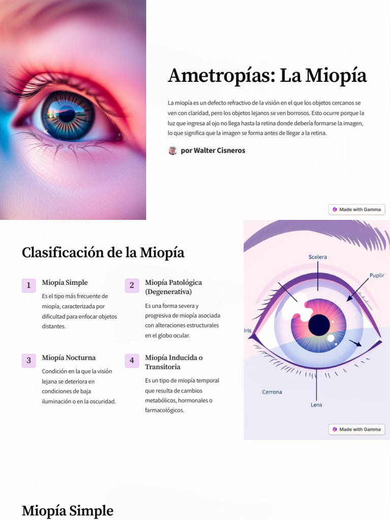 Ametropias La Miopia | PDF | Miopía | Ojo humano
