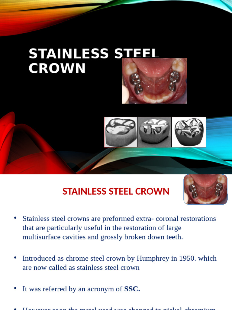 Stainless Steel Crowns in Pediatric Dentistry | PDF | Dentistry ...